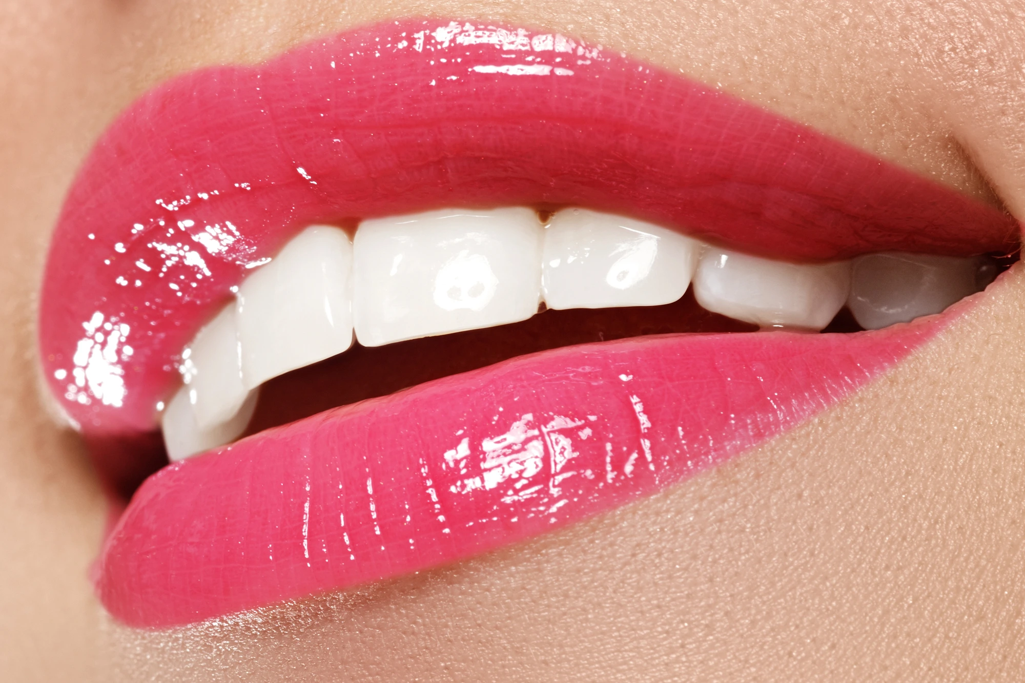 The “Natural Smile” Trend: Why Subtle Orthodontics Are Taking Over